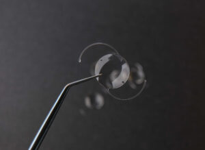 Choosing the Right Intraocular Lens for Cataract Surgery: Exploring ...